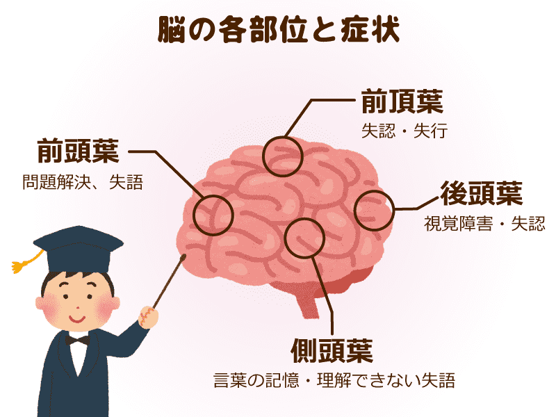 脳梗塞後のリハビリに! 自宅でできる簡単ストレッチ3選|介護の教科書|みんなの介護